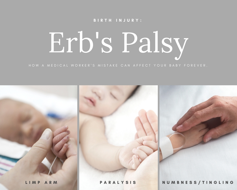 Erb's Palsy Lawyer Newark, NJ | Birth Injury Lawyer Englishtown, NJ
